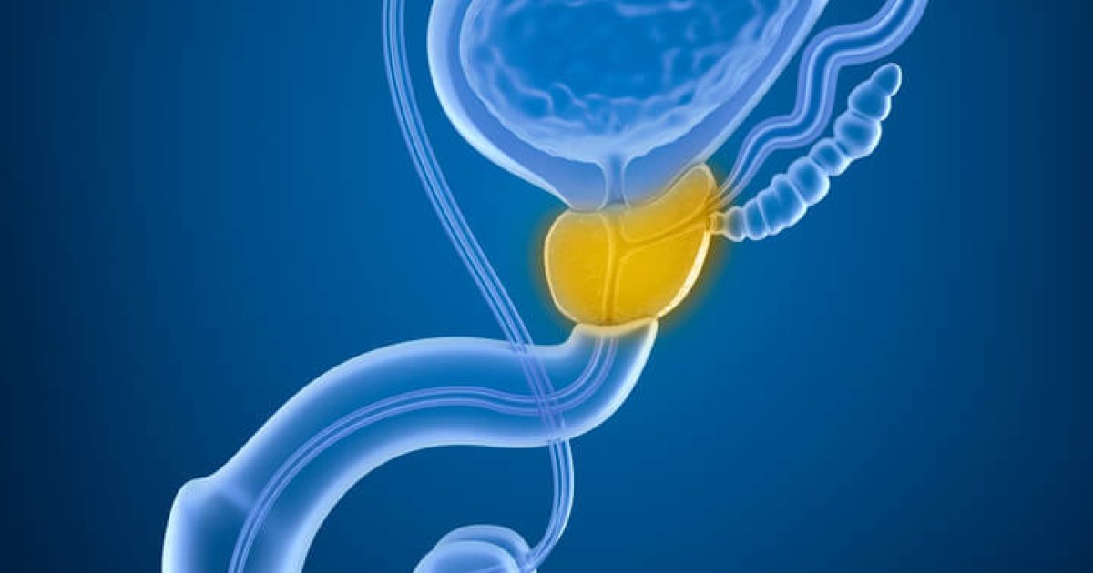 Prostata-OP - Verfahren, Risiken und Reha