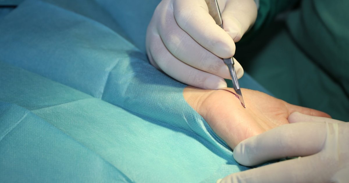 Hand-OP - Verfahren und Reha nach dem Eingriff